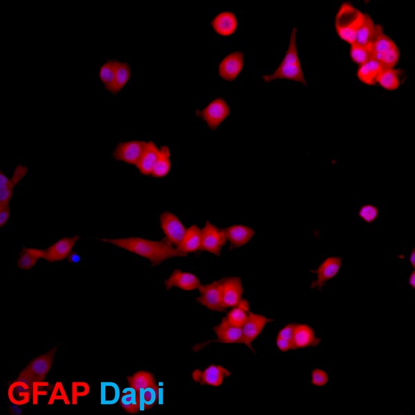 N2A Psen1/Psen2 Double Knockout Mouse Neuroblastoma Cell Line | SCC297
